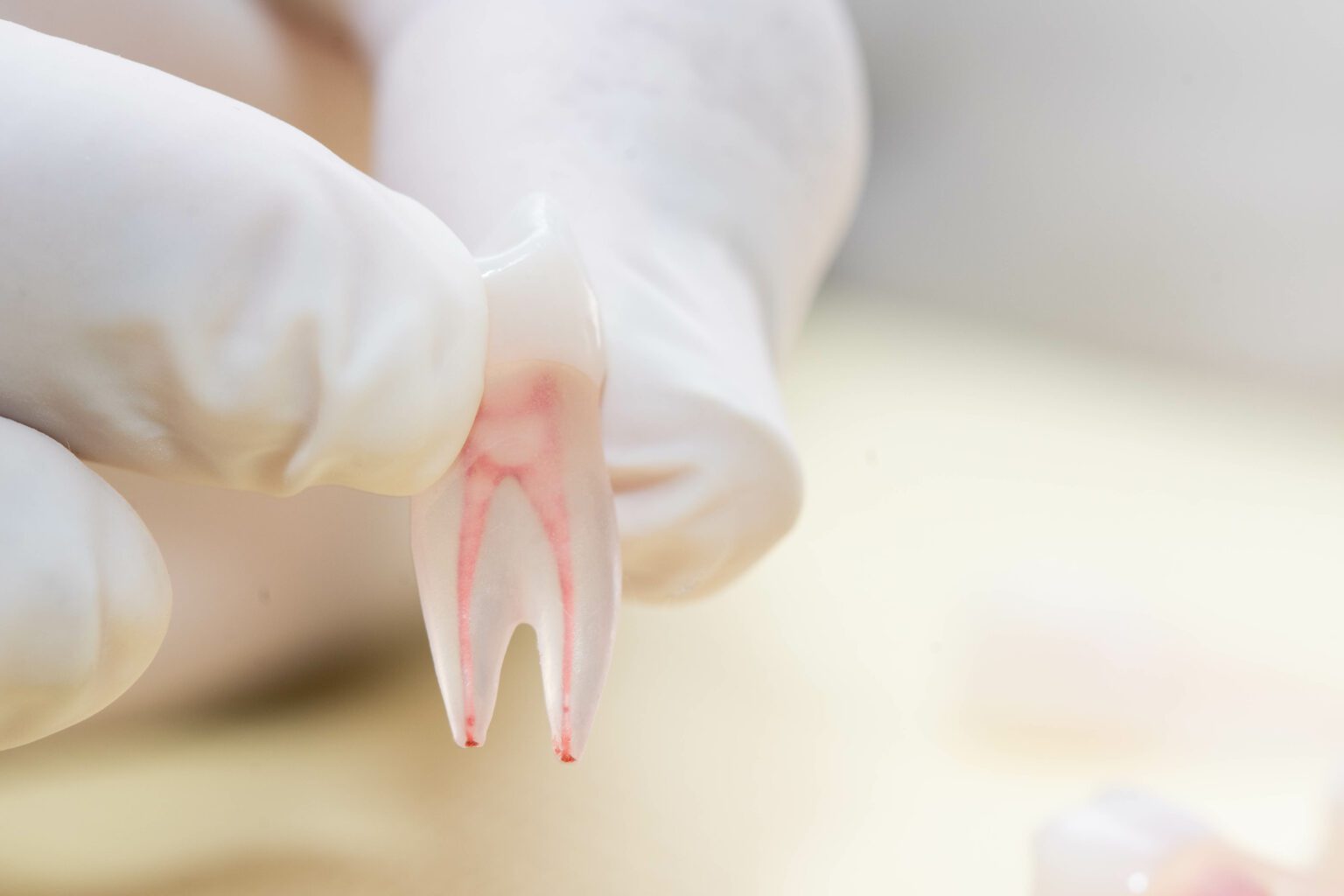 Endodontic Microsurgery: 5-Step Process to Save Your Teeth